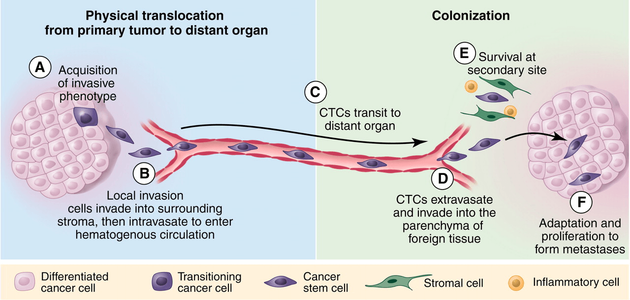 Circulating Tumor Cell (CTC) FISH | Creative Bioarray