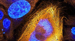 Immortalized Human Cells - Creative Bioarray | Creative Bioarray